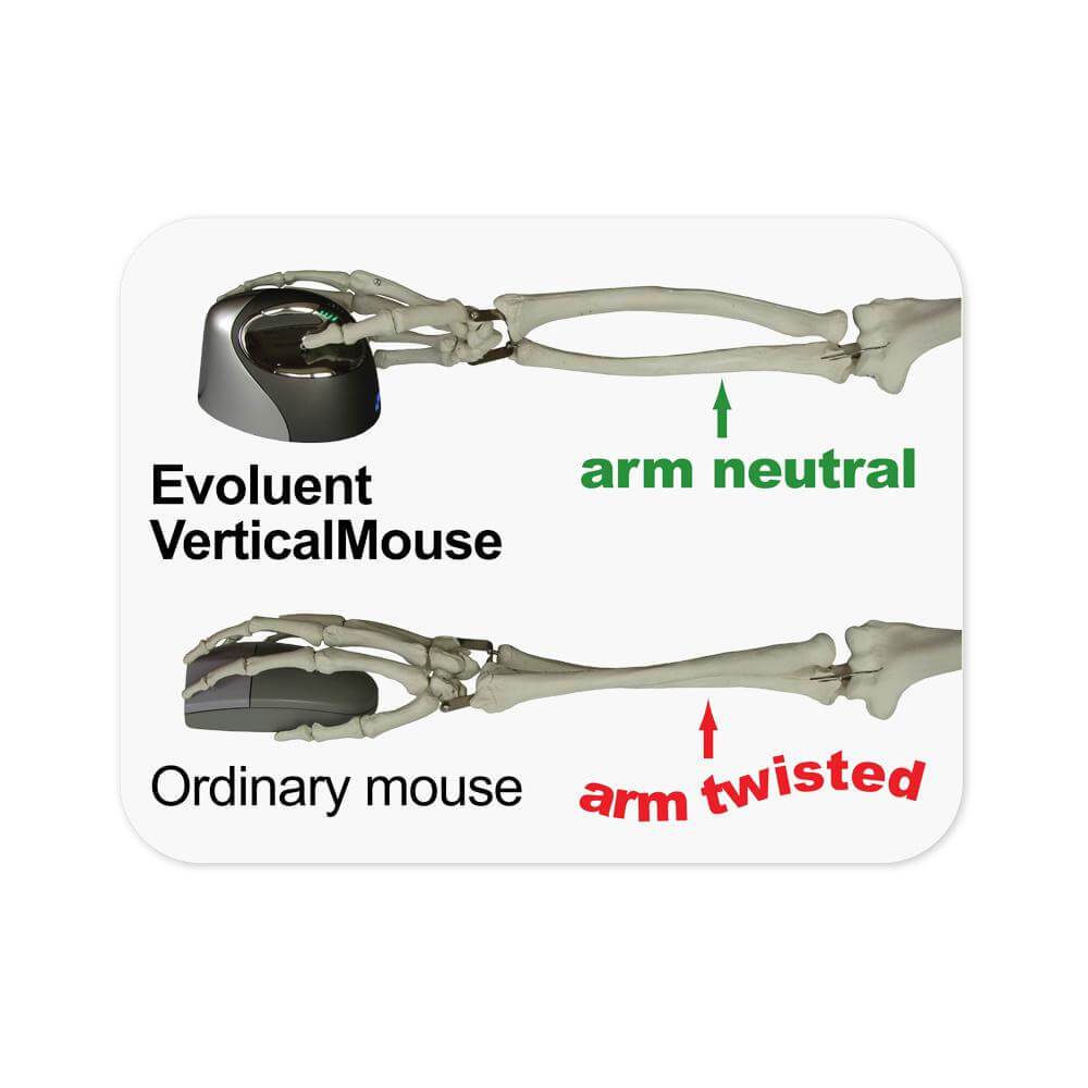 Evoluent Vertical Mouse 4 for Enhanced Comfort and Ergonomic ...